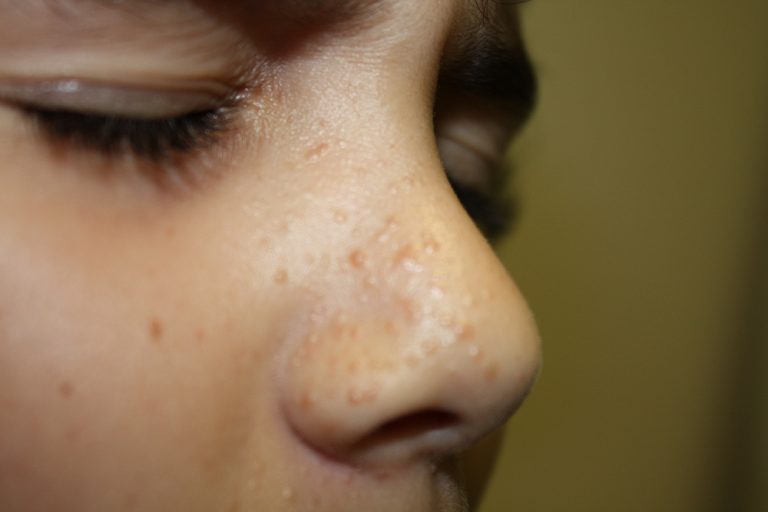 Pop Quiz Answer #26 - 9/28 - Next Steps in Dermatology