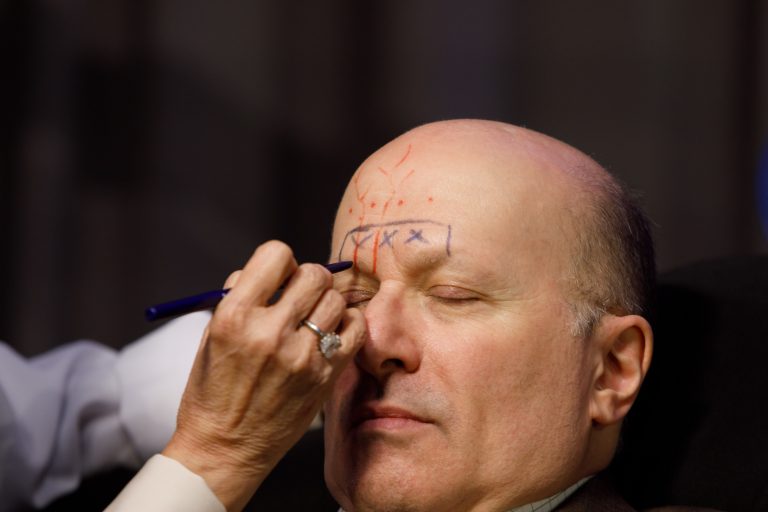 Facial Anatomy: Pearls from a Master Injector - Next Steps in Dermatology