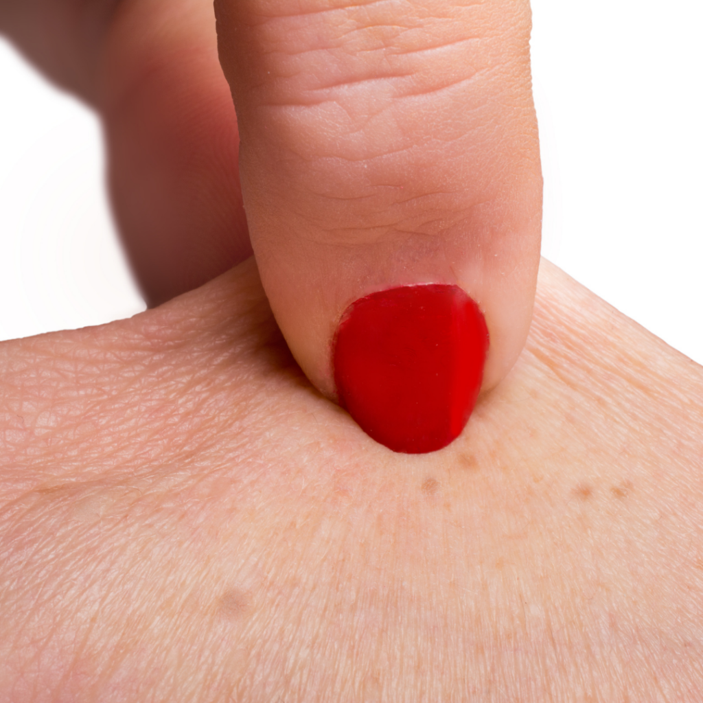 New in Dermatology from The Outside World: From Grey Hair to Melanoma ...