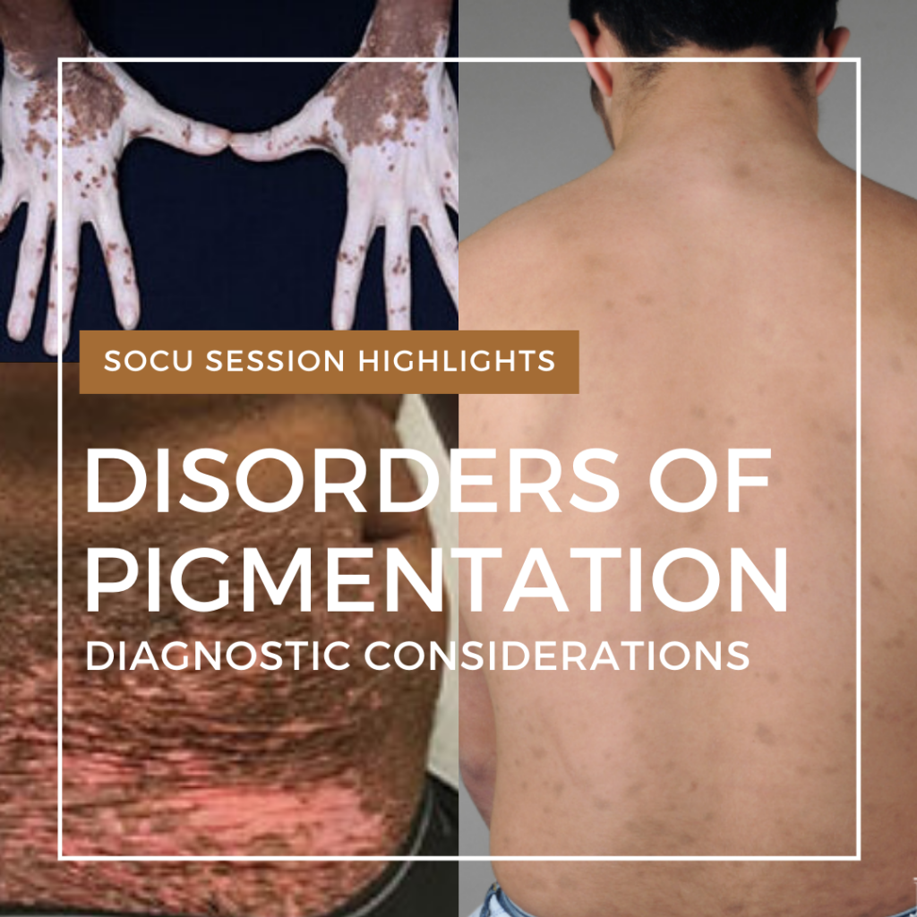 Disorders of Pigmentation: Diagnostic Considerations - Next Steps in ...