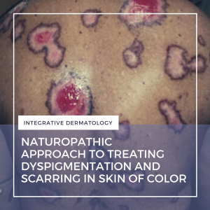 Naturopathic Approach to Treating Dyspigmentation and Scarring in Skin ...