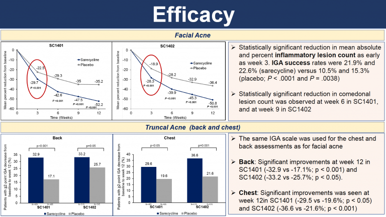 ODAC Scientific Poster Highlights: Acne & Rosacea - Next Steps in ...