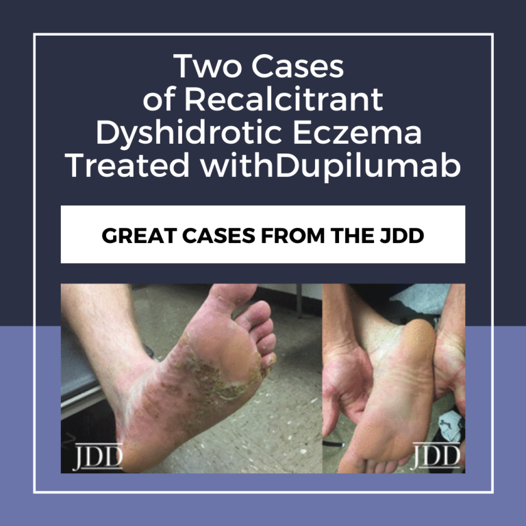 Dupilumab_JDDCaseReport_IG - Next Steps in Dermatology