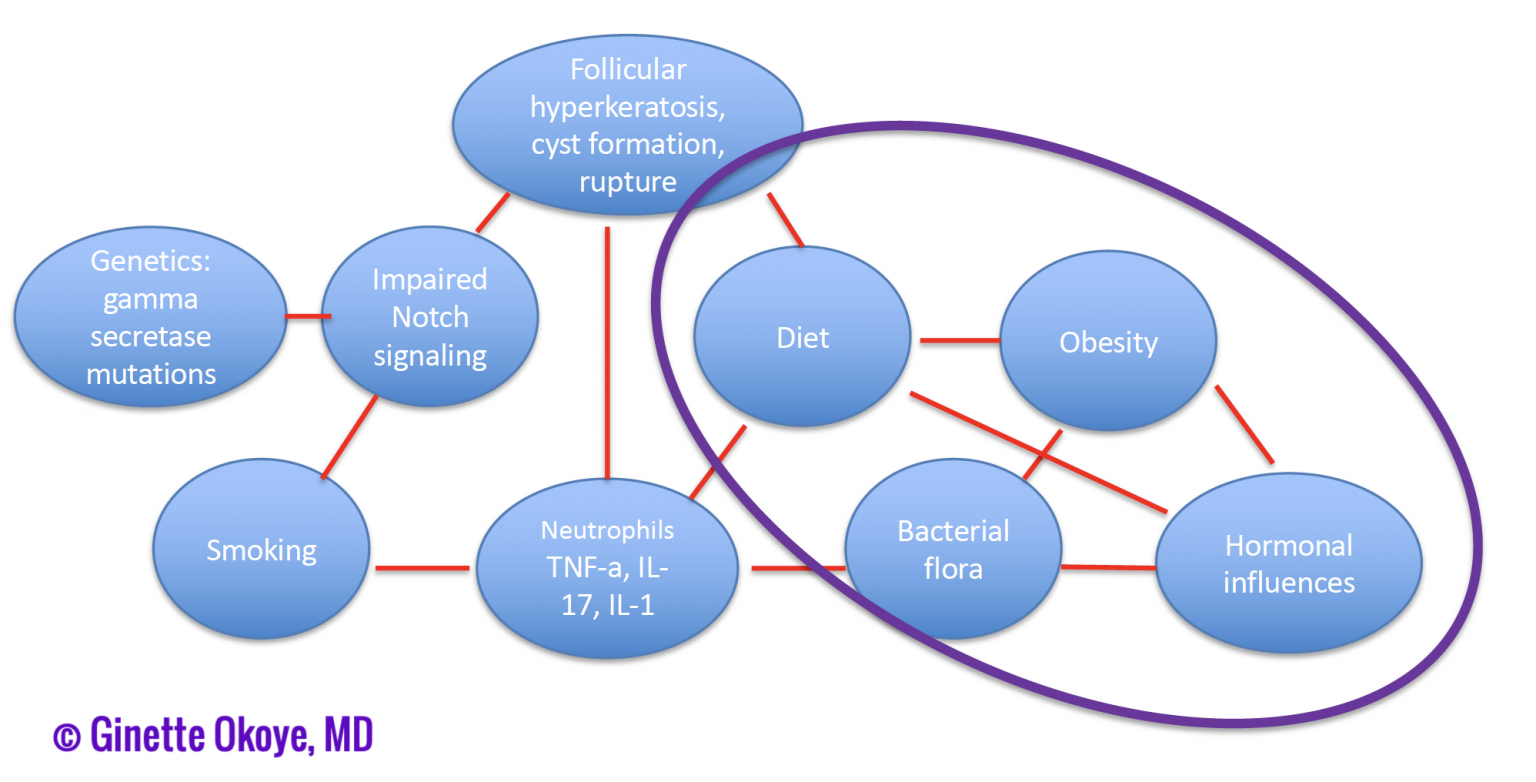 Treating Hidradenitis Suppurativa (HS) | Dr. Okoye's Approach - Next ...