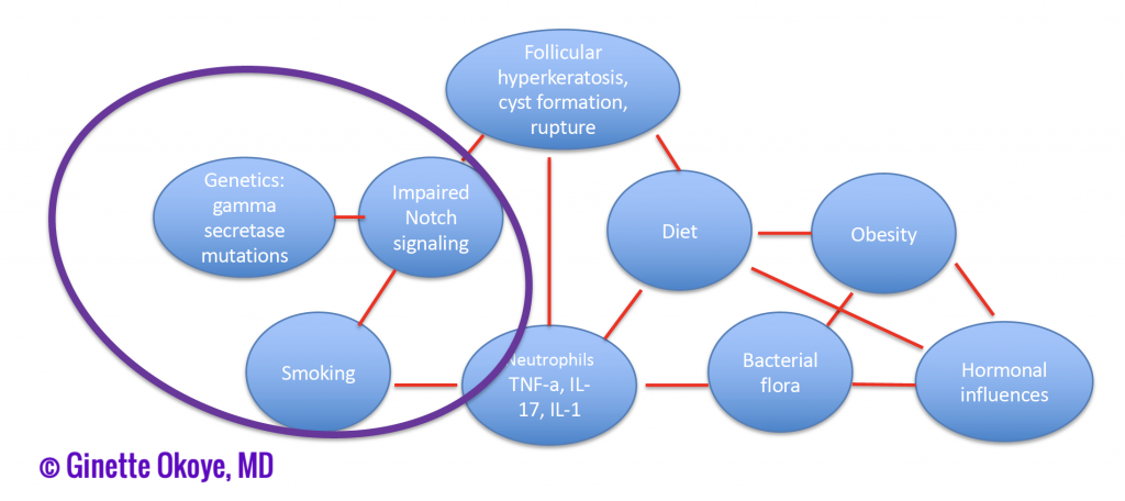 Treating Hidradenitis Suppurativa (HS) | Dr. Okoye's Approach - Next ...