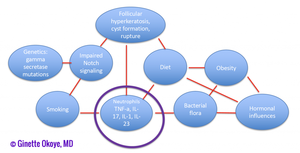 Treating Hidradenitis Suppurativa (HS) | Dr. Okoye's Approach - Next ...