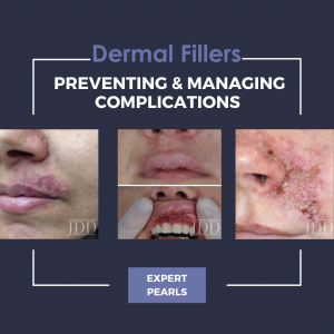 delayed-onset nodules Archives - Next Steps in Dermatology