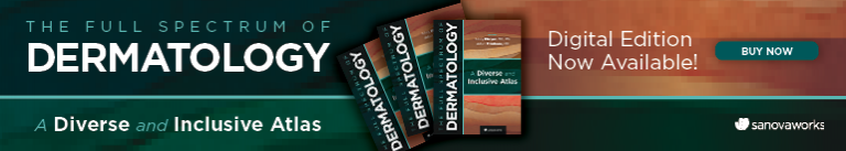 For Sale Now! Digital Edition of The Full Spectrum of Dermatology: A ...