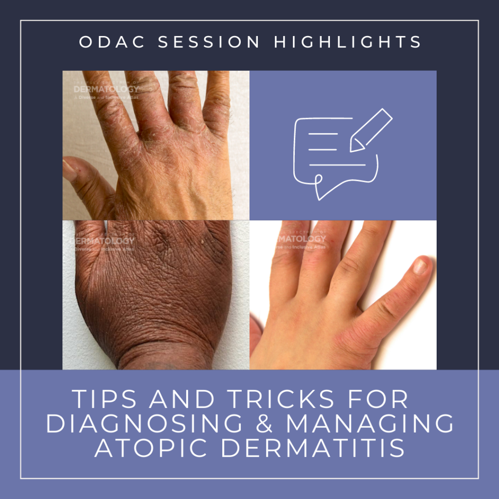 Tips and Tricks for Diagnosing & Managing Atopic Dermatitis (AD) - Next ...