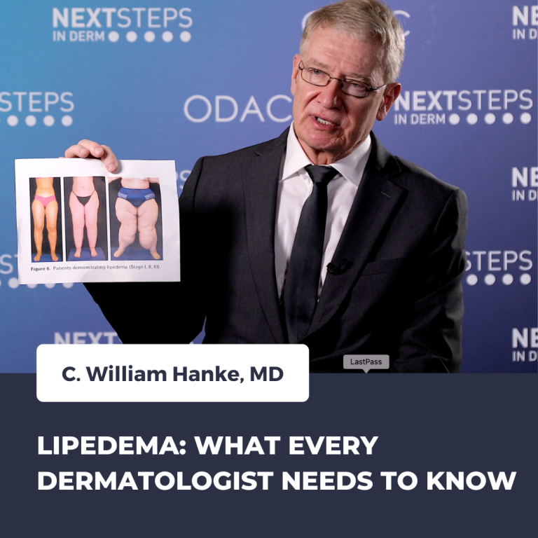 Lipedema: What Every Dermatologist Needs to Know - Next Steps in ...