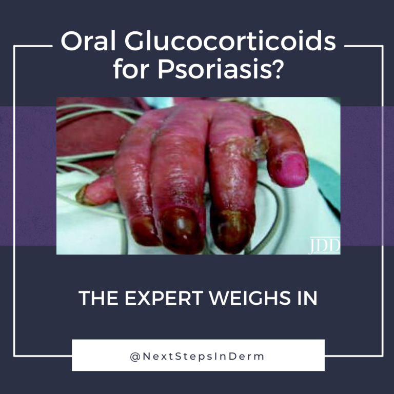 Oral Glucocorticoids for Psoriasis? The Expert Weighs In - Next Steps ...