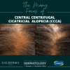 The Many Faces of Central Centrifugal Cicatricial Alopecia (CCCA ...