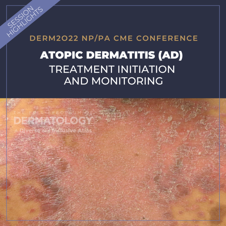 Atopic Dermatitis (AD) Treatment Initiation and Monitoring - Next Steps ...