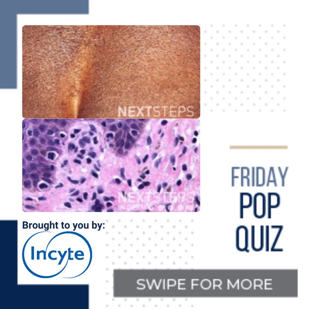Scaly Papules - Friday Pop Quiz 3/31/2023 - Next Steps in Dermatology