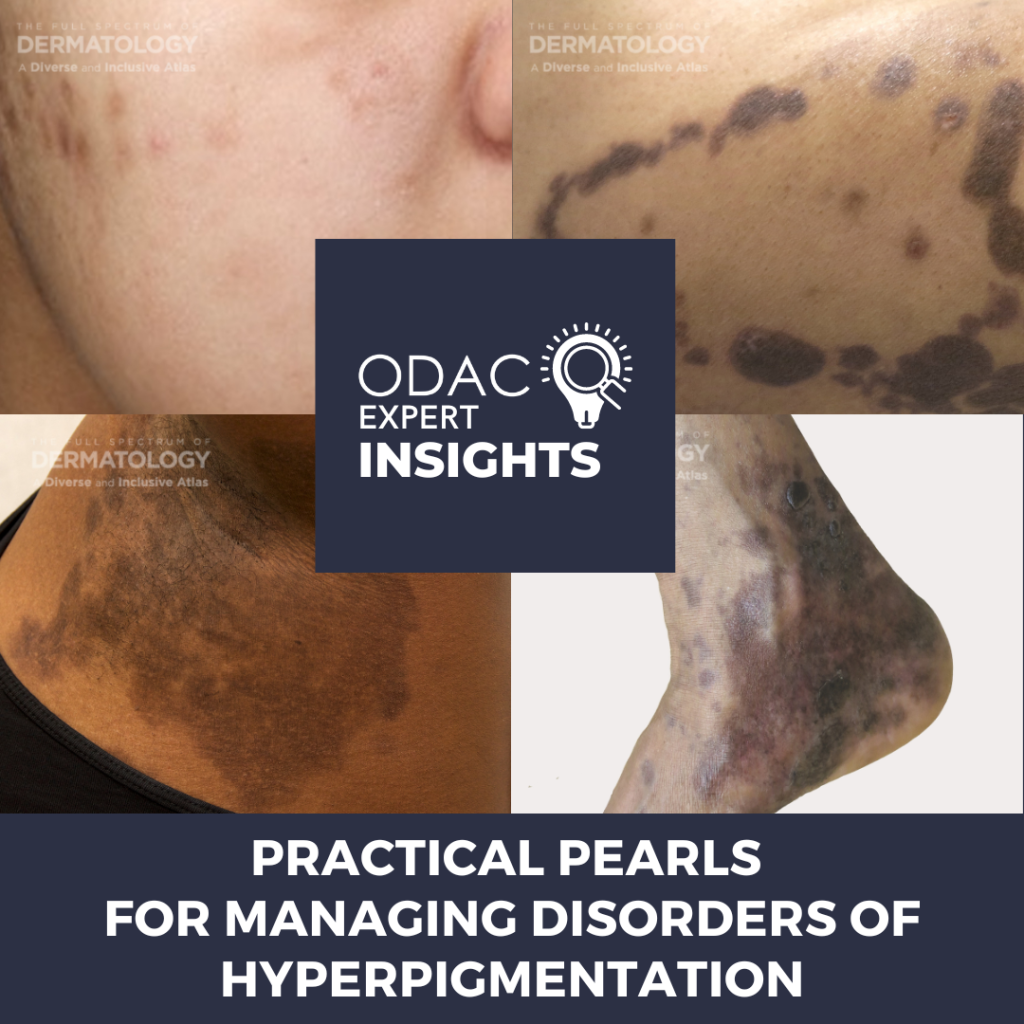 Practical Pearls for Diagnosing Disorders of Hyperpigmentation - Next ...