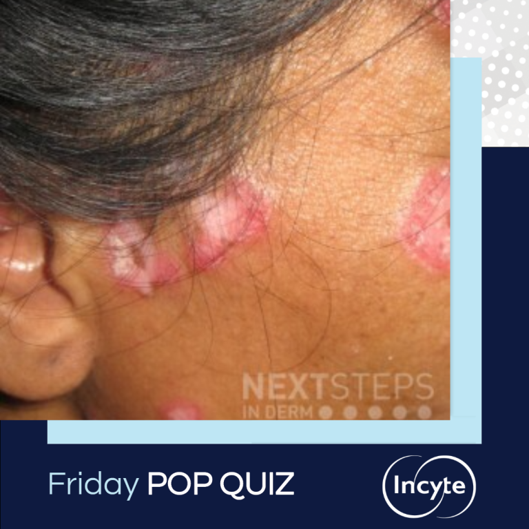 Skin Complications - Friday Pop Quiz 6/15/2023 - Next Steps in Dermatology