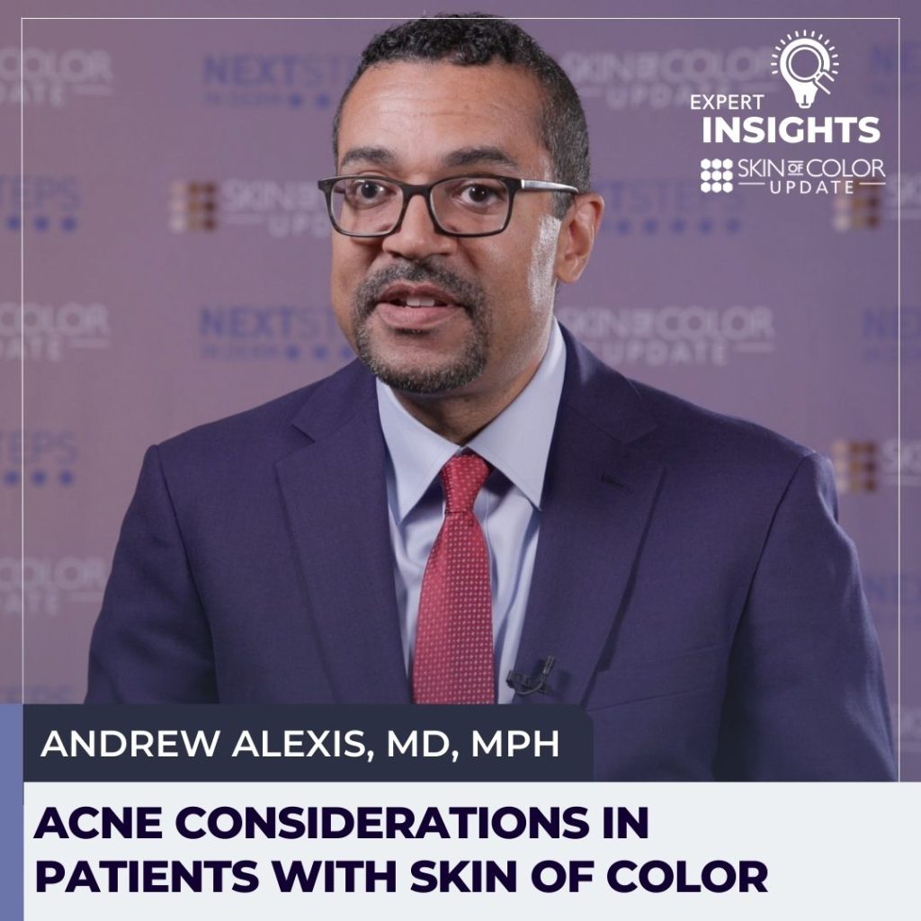 Acne Considerations in Patients with Skin of Color - Next Steps in ...