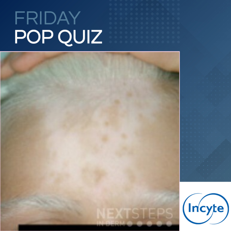 Friday Pop Quiz #234 - Next Steps in Dermatology