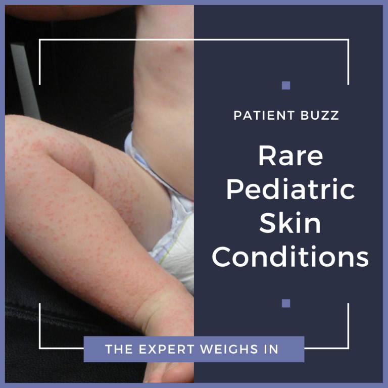 Patient Buzz: Rare Pediatric Skin Conditions | The Expert Weighs In ...