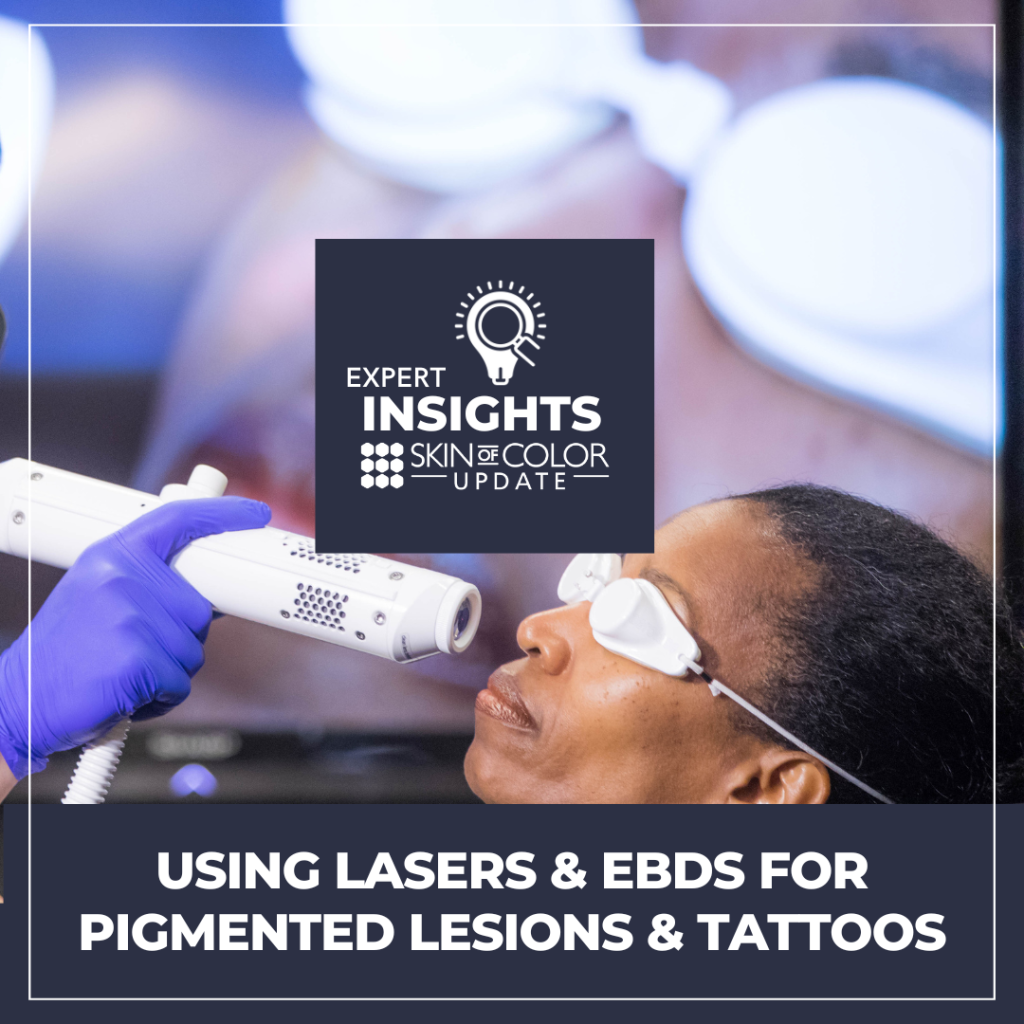 Using Lasers & EBDs for Pigmented Lesions & Tattoos - Next Steps in ...