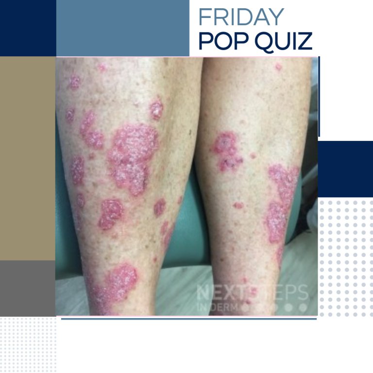 Derm In-Review Archives - Page 2 of 75 - Next Steps in Dermatology