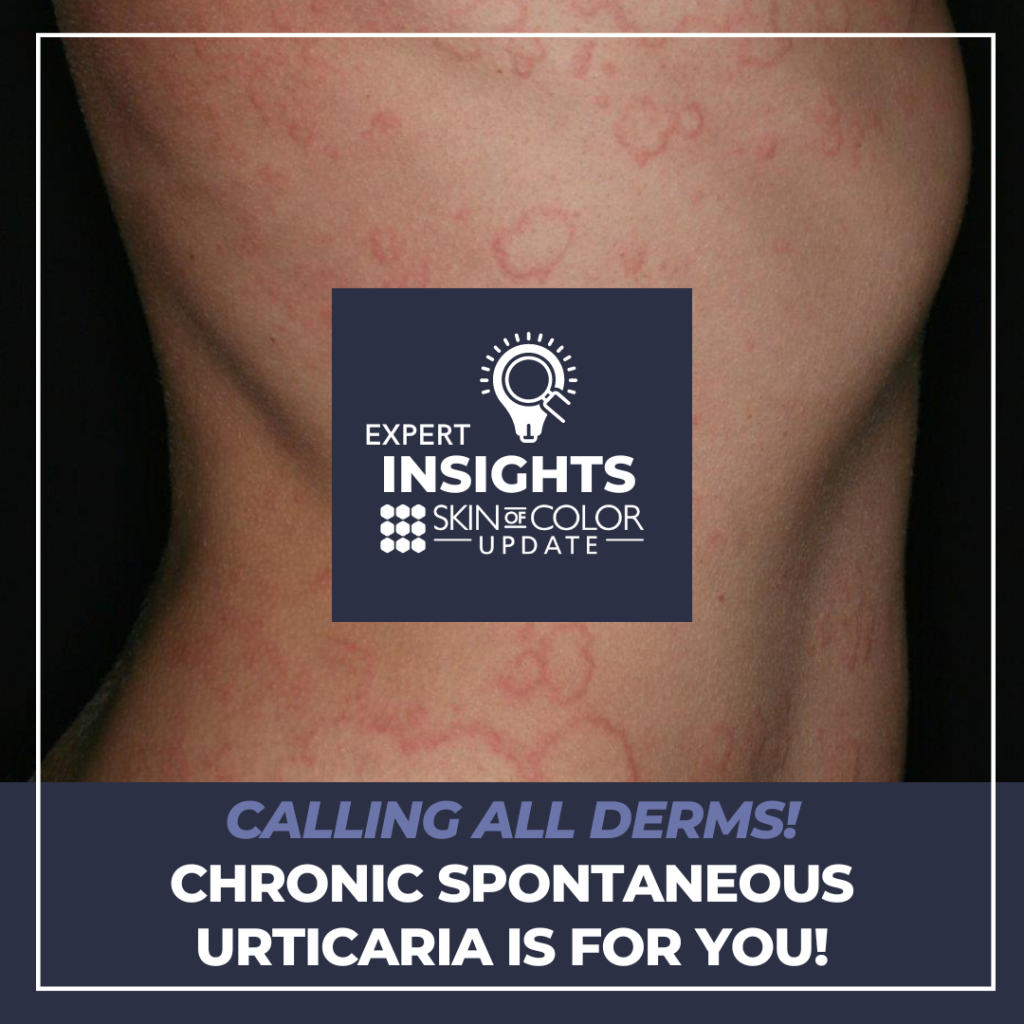 CSU - Next Steps in Dermatology