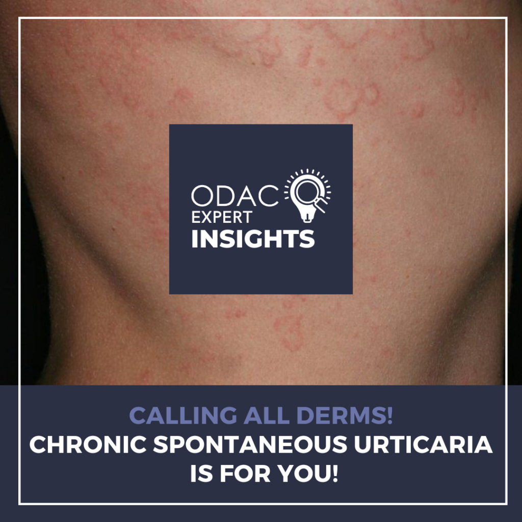 Calling All Derms! Chronic Spontaneous Urticaria Is For You! - Next ...
