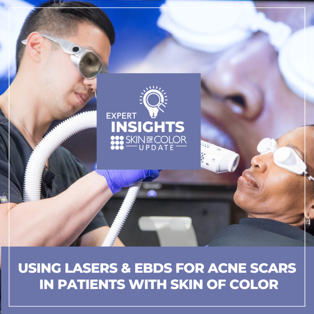 Using Lasers & EBDs for Acne Scars in Patients with Skin of Color ...