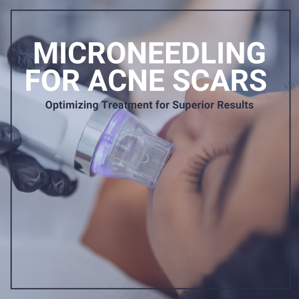 Microneedling for Acne Scars: Optimizing Treatment for Superior Results ...