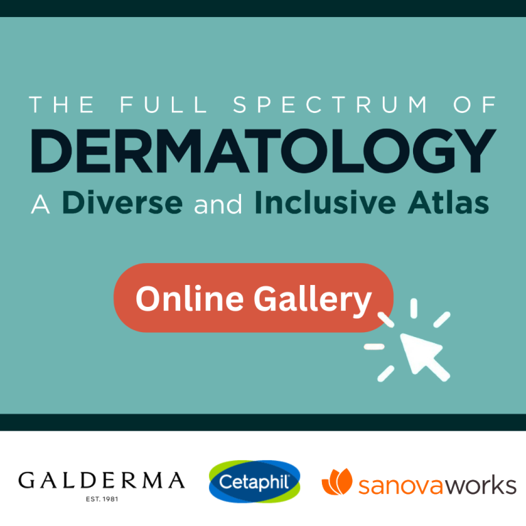 How to Use The Full Spectrum of Dermatology: A Diverse and Inclusive ...