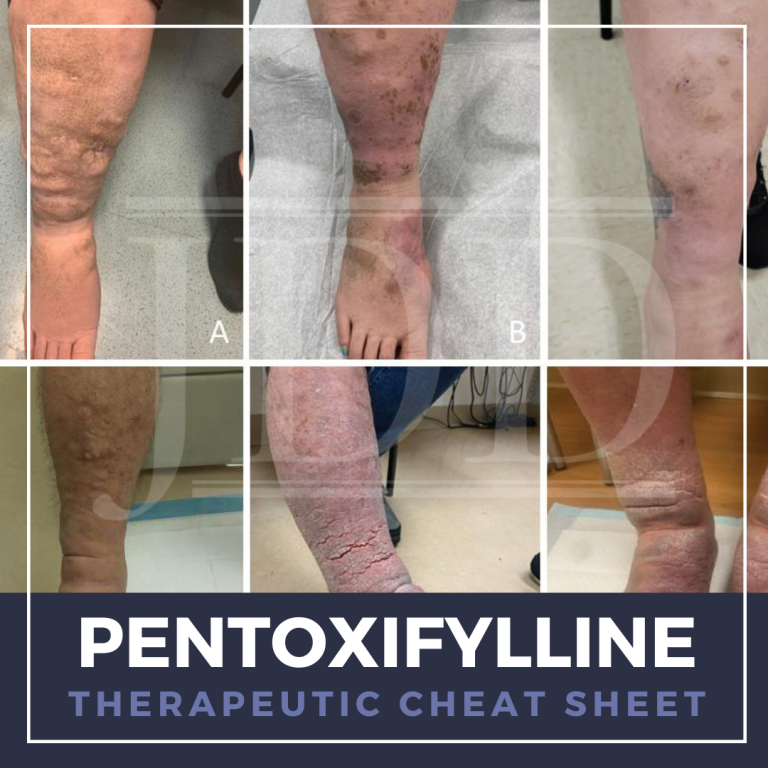 Lichen sclerosis et atrophicus Archives - Next Steps in Dermatology