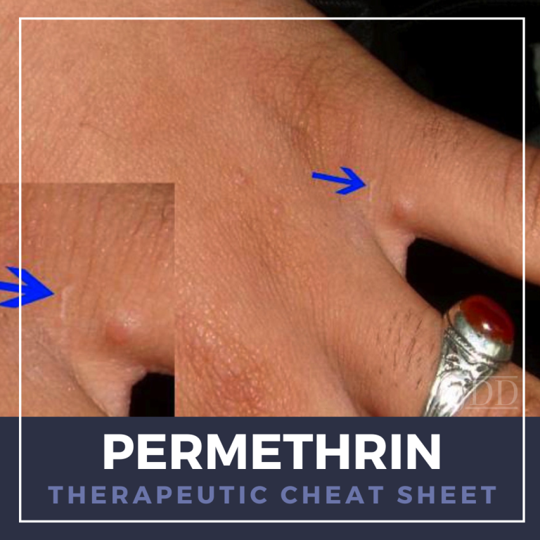 Permethrin Therapeutic Cheat Sheet - Next Steps in Dermatology