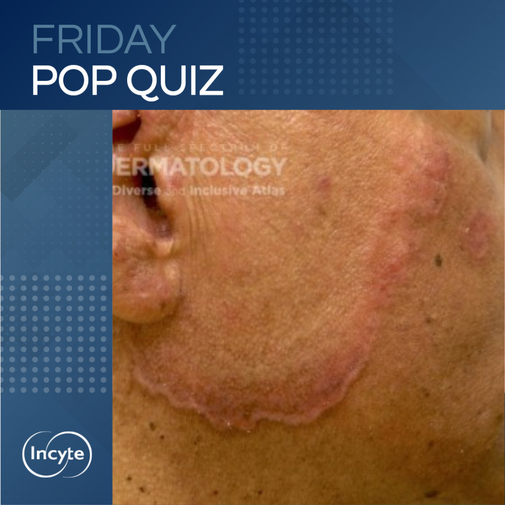 Derm In-Review Archives - Next Steps in Dermatology