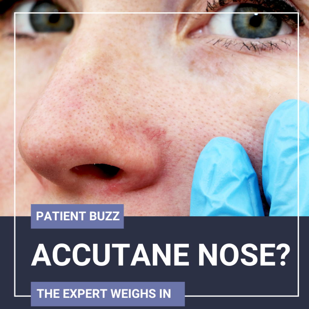 Accutane and facial structure Archives - Next Steps in Dermatology