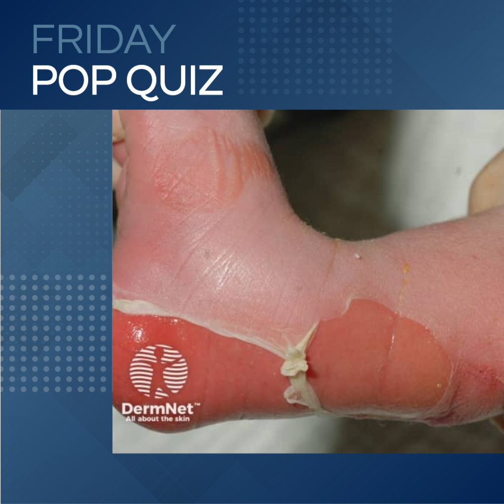 skin collagen Archives - Next Steps in Dermatology