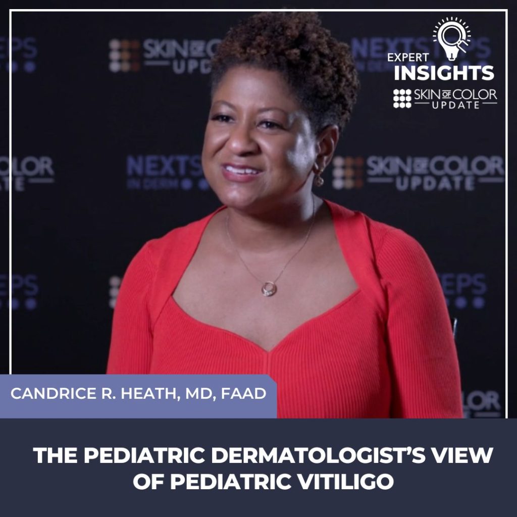 The Pediatric Dermatologist’s View of Pediatric Vitiligo - Next Steps ...
