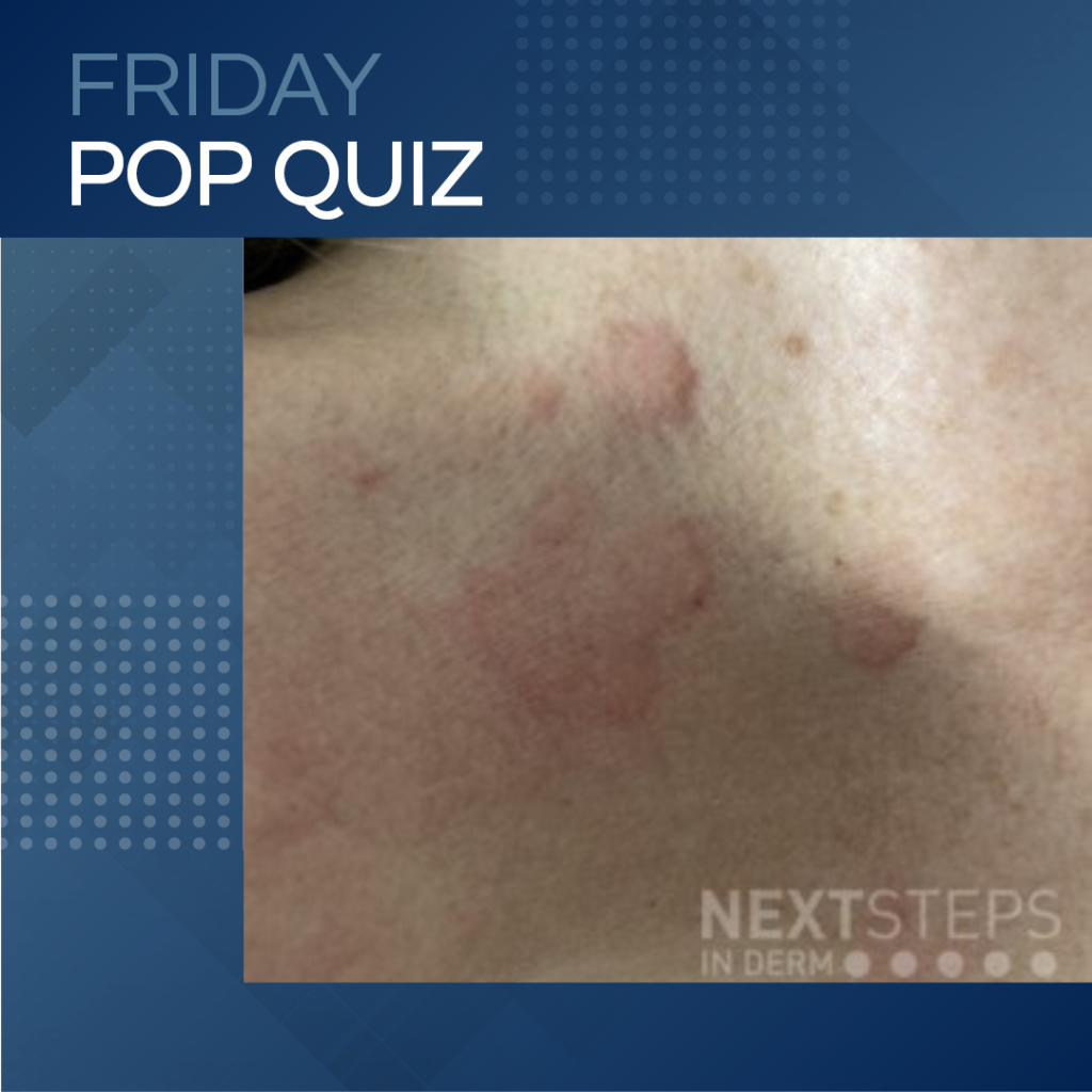 Home Page - Next Steps in Dermatology