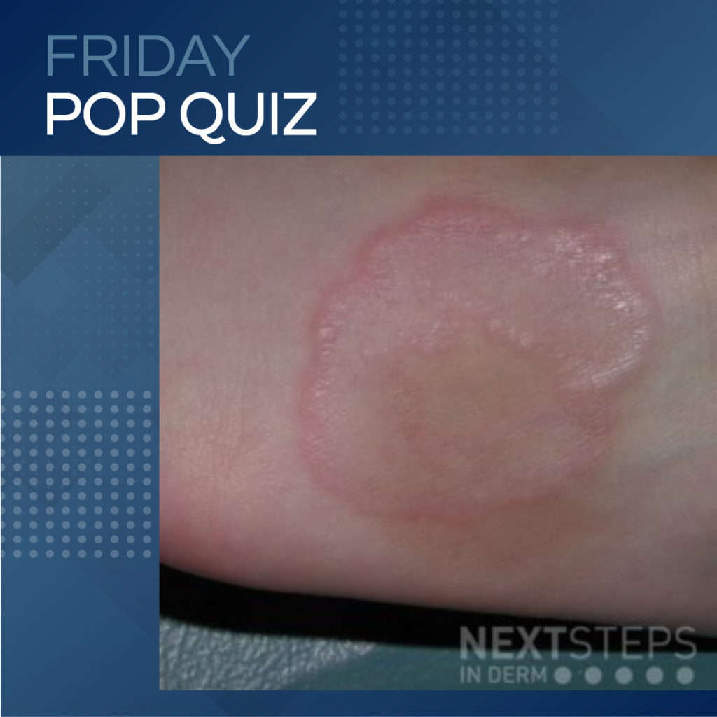 Derm In-Review Archives - Next Steps in Dermatology