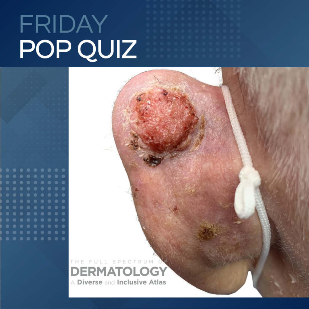 Derm In-Review Archives - Next Steps in Dermatology