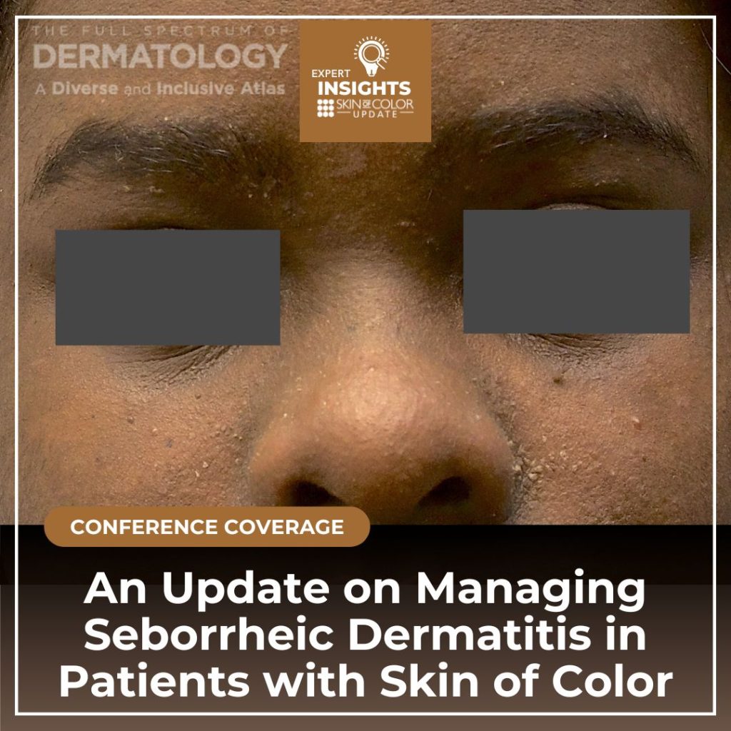 2024 Skin of Color Update seborrheic dermatitis Archives - Next Steps ...