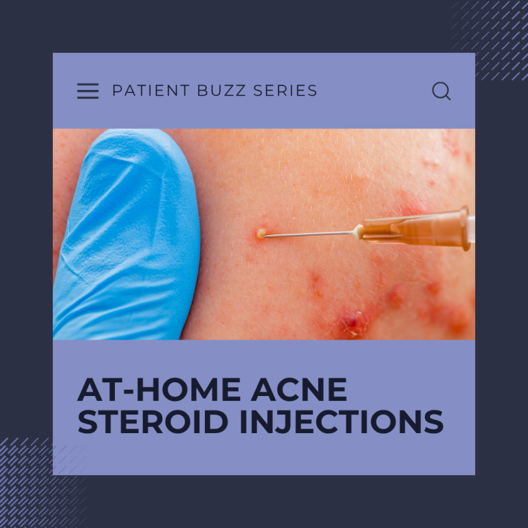 Patient Buzz Series: At-Home Acne Steroid Injections - Next Steps in ...