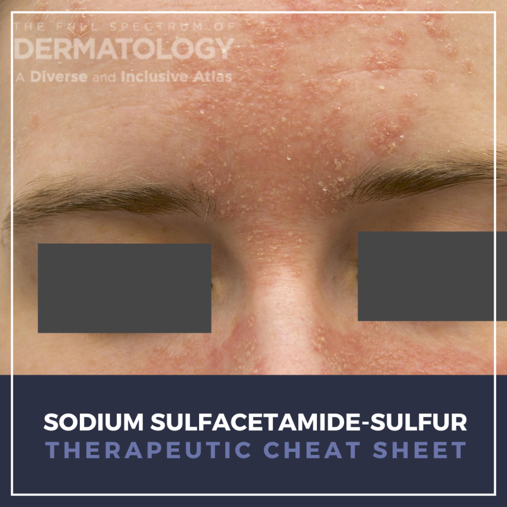 sulfur-sulfacetamide therapeutic cheat sheet Archives - Next Steps in ...