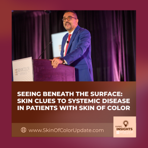 Seeing Beneath the Surface: Skin Clues to Systemic Disease in Patients ...